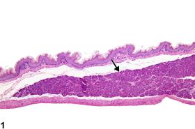 Stomach - Ectopic Tissue - Nonneoplastic Lesion Atlas