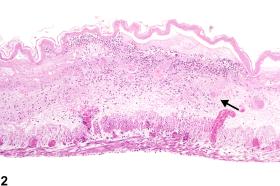 Stomach - Necrosis - Nonneoplastic Lesion Atlas