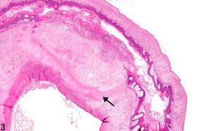 Stomach - Necrosis - Nonneoplastic Lesion Atlas