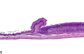 Stomach - Atrophy - Nonneoplastic Lesion Atlas