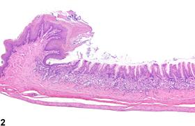 Stomach - Atrophy - Nonneoplastic Lesion Atlas