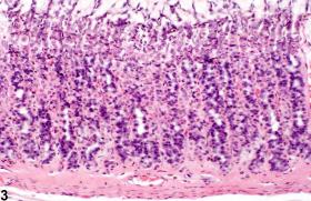 Stomach - Atrophy - Nonneoplastic Lesion Atlas
