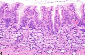 Stomach - Atrophy - Nonneoplastic Lesion Atlas