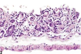 Stomach - Necrosis - Nonneoplastic Lesion Atlas