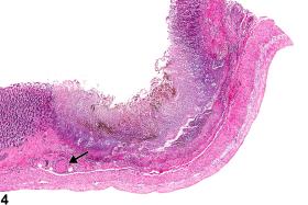 Stomach - Necrosis - Nonneoplastic Lesion Atlas