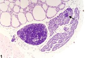 Parathyroid gland - Ectopic Tissue - Nonneoplastic Lesion Atlas