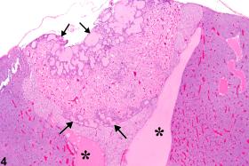 Pituitary gland - Cyst - Nonneoplastic Lesion Atlas