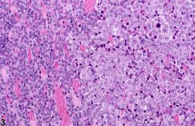 Pituitary gland - Hyperplasia - Nonneoplastic Lesion Atlas