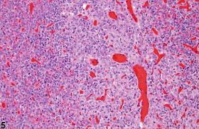 Pituitary gland - Hyperplasia - Nonneoplastic Lesion Atlas