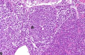 Pituitary gland - Hyperplasia - Nonneoplastic Lesion Atlas