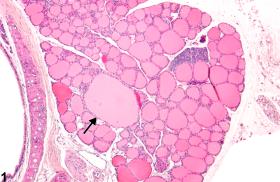 Thyroid Gland, Follicle - Dilation - Nonneoplastic Lesion Atlas