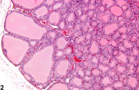 Follicular Epithelium