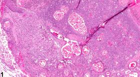 Clitoral gland - Inflammation - Nonneoplastic Lesion Atlas