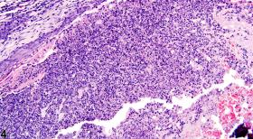 Clitoral gland - Inflammation - Nonneoplastic Lesion Atlas