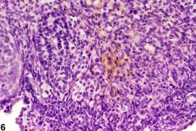 Ovary - Atrophy - Nonneoplastic Lesion Atlas