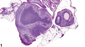 Ovary - Inflammation - Nonneoplastic Lesion Atlas