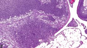 Ovary - Inflammation - Nonneoplastic Lesion Atlas