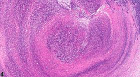 Ovary - Inflammation - Nonneoplastic Lesion Atlas