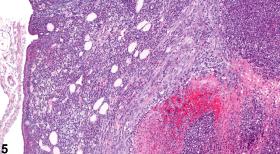Ovary - Inflammation - Nonneoplastic Lesion Atlas