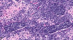 Ovary - Inflammation - Nonneoplastic Lesion Atlas