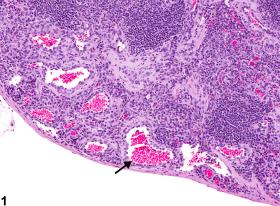 Spleen - Angiectasis - Nonneoplastic Lesion Atlas