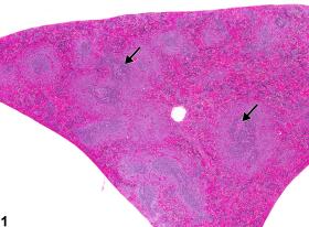 Spleen - Atrophy - Nonneoplastic Lesion Atlas