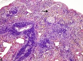 Spleen - Atrophy - Nonneoplastic Lesion Atlas