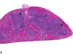 Spleen - Hyperplasia, Lymphocyte - Nonneoplastic Lesion Atlas