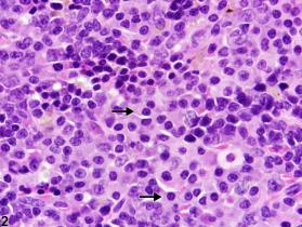 Spleen - Hyperplasia, Plasma Cell - Nonneoplastic Lesion Atlas