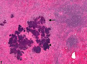 Spleen - Inflammation - Nonneoplastic Lesion Atlas