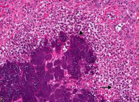 Spleen - Inflammation - Nonneoplastic Lesion Atlas