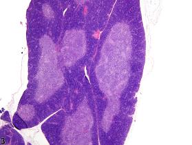 Thymus - Atrophy - Nonneoplastic Lesion Atlas