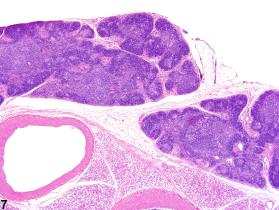 Thymus - Atrophy - Nonneoplastic Lesion Atlas