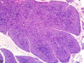 Thymus - Atrophy - Nonneoplastic Lesion Atlas
