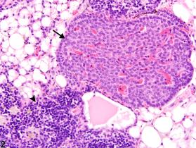 Thymus - Ectopic Tissue - Nonneoplastic Lesion Atlas