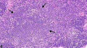Thymus - Involution - Nonneoplastic Lesion Atlas