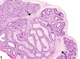 Epididymis - Amyloid - Nonneoplastic Lesion Atlas