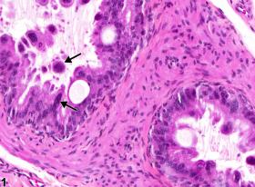 Epididymis, Epithelium - Karyomegaly - Nonneoplastic Lesion Atlas
