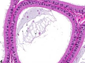 Epididymis - Hypospermia - Nonneoplastic Lesion Atlas