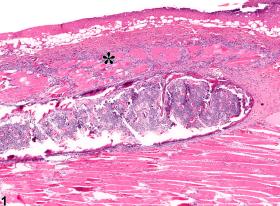 Penis - Inflammation - Nonneoplastic Lesion Atlas