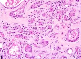 Preputial gland - Atrophy - Nonneoplastic Lesion Atlas
