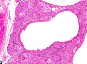 Preputial Gland, Duct - Dilation - Nonneoplastic Lesion Atlas