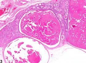 Preputial Gland, Duct - Dilation - Nonneoplastic Lesion Atlas
