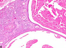 Preputial Gland, Duct - Dilation - Nonneoplastic Lesion Atlas
