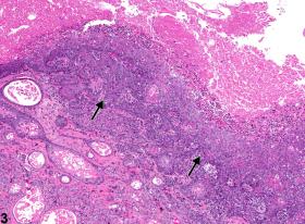 Preputial gland - Hyperplasia - Nonneoplastic Lesion Atlas