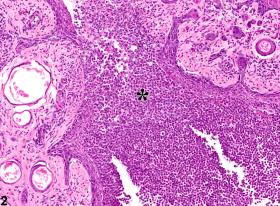 Preputial gland - Inflammation - Nonneoplastic Lesion Atlas