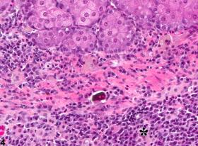 Preputial gland - Inflammation - Nonneoplastic Lesion Atlas