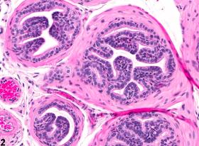 Seminal vesicle - Atrophy - Nonneoplastic Lesion Atlas