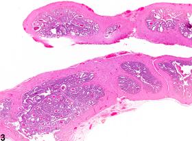 Seminal vesicle - Atrophy - Nonneoplastic Lesion Atlas