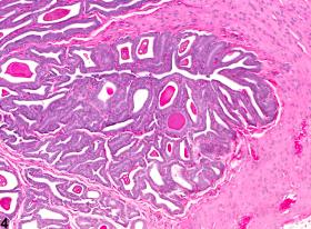 Seminal vesicle - Atrophy - Nonneoplastic Lesion Atlas